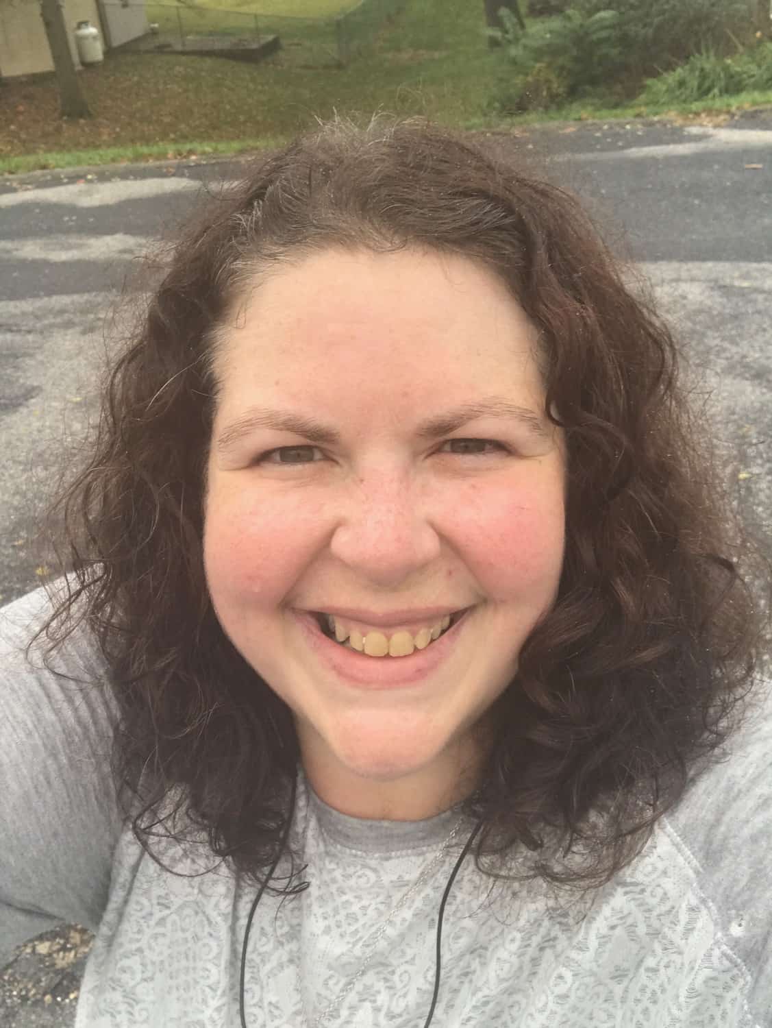 Bariatric Gastric Sleeve Surgery Update And Results 7 Months Post Op